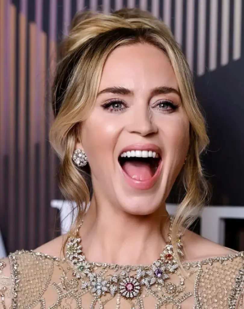 Die Zahnumwandlung von Emily Blunt über die Jahre | Lema Dental Clinic