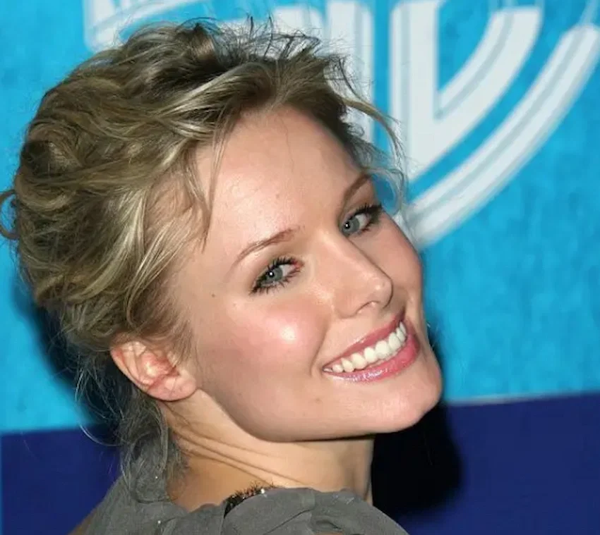 🤩 Kristen Bell's Unique Teeth Transformation | LEMA