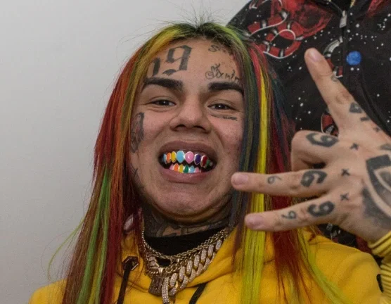 💎 6ix9ine’s Teeth: From Grillz to Glam | LEMA