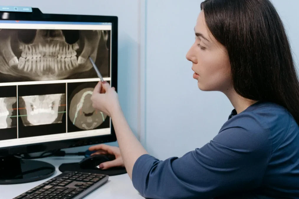 D7311: Alveoloplasty Dental Code for a Smooth Recovery | LEMA