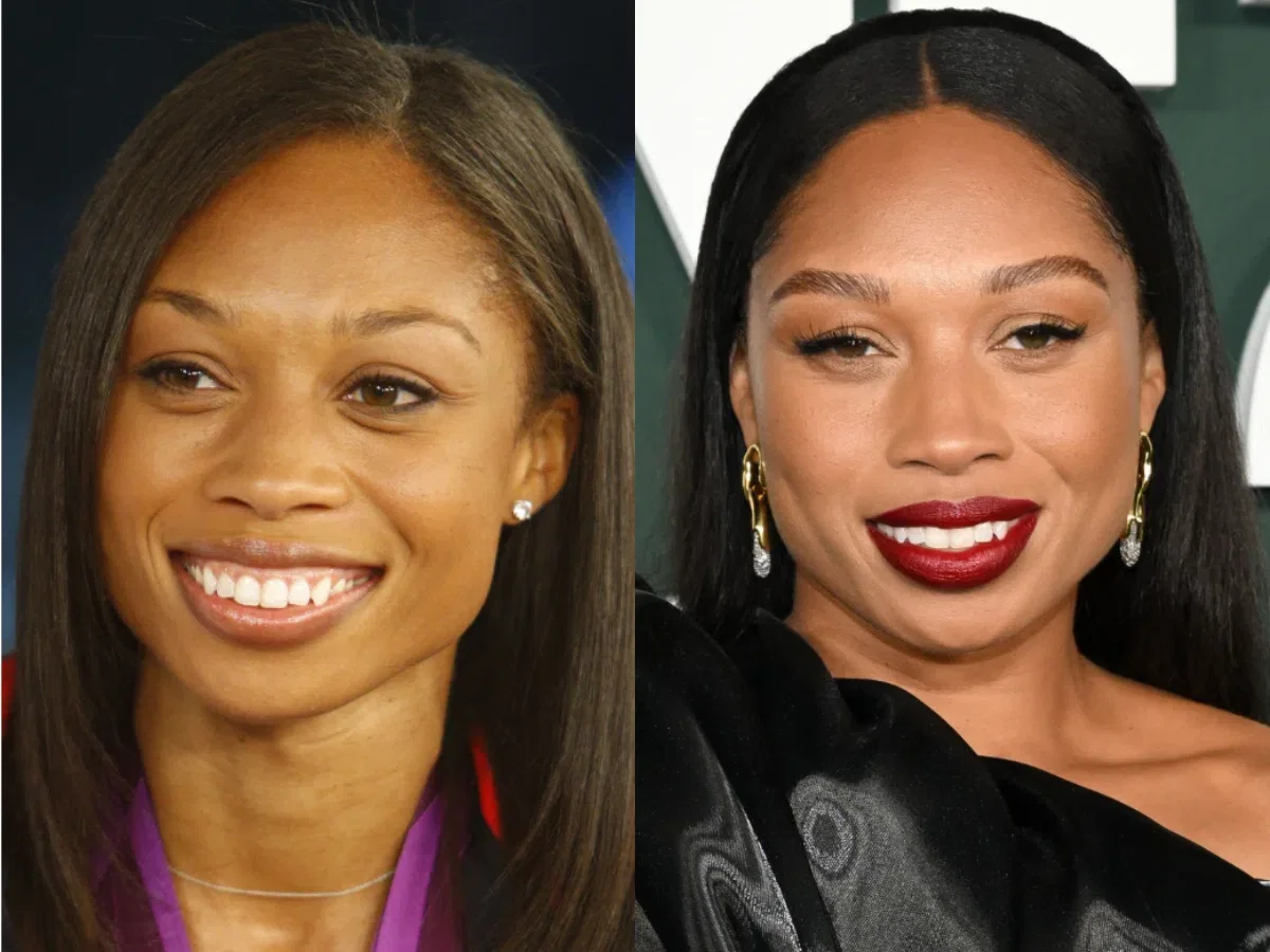Allyson Felix’s Teeth Now After Veneers | LEMA