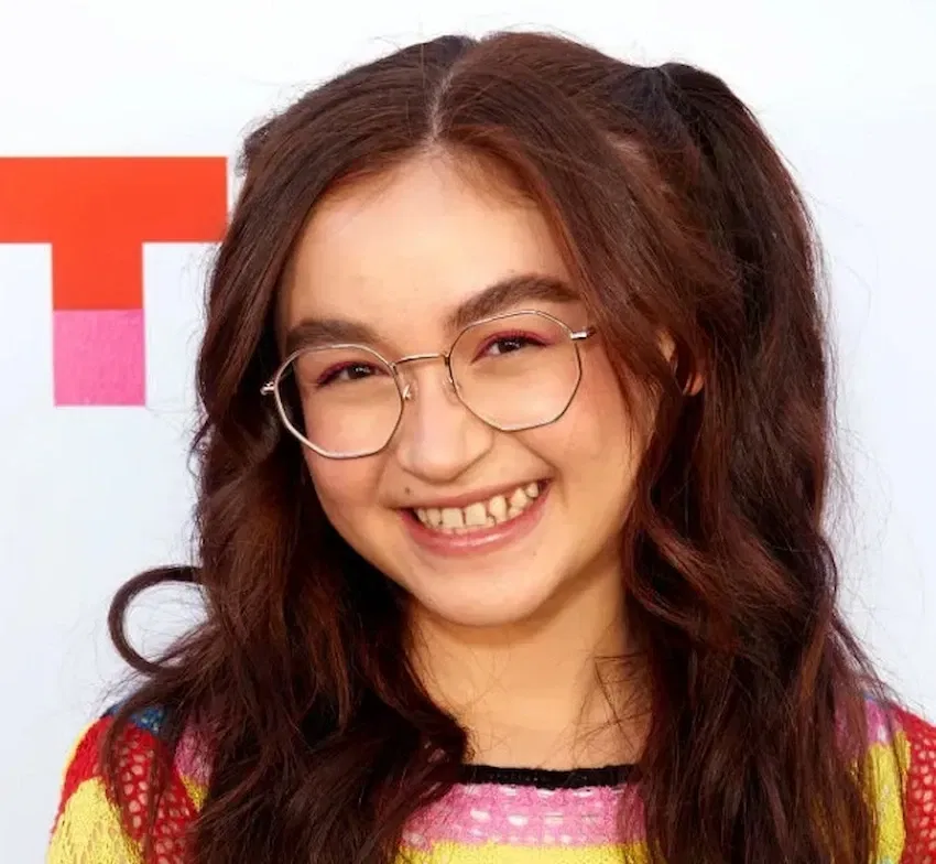 Anna Cathcart Teeth (Old/New): Before and Afters | LEMA