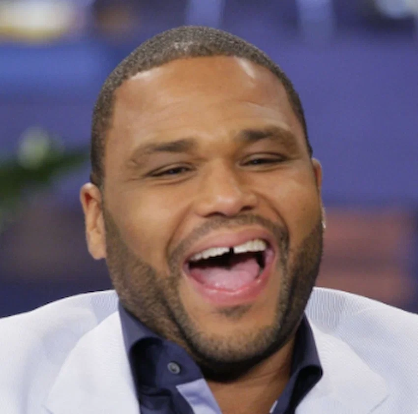 😁 Anthony Anderson dantys (senos/naujos)