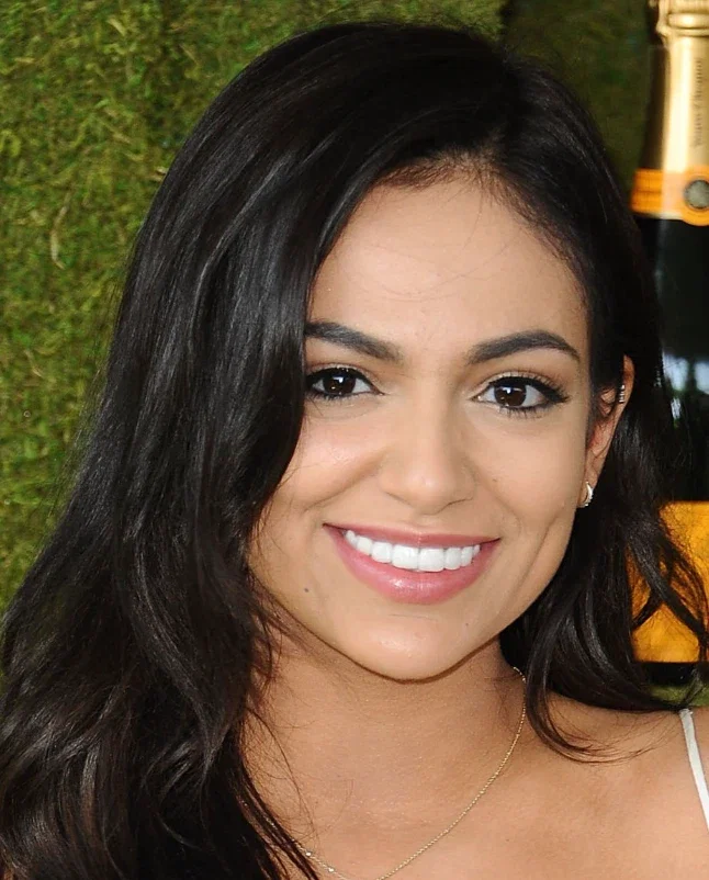 🦷 La increíble transformación de los dientes de Bethany Mota | Lema ...