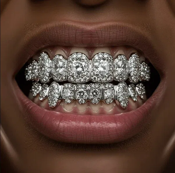 How Do You Put Diamonds in Your Teeth? | LEMA