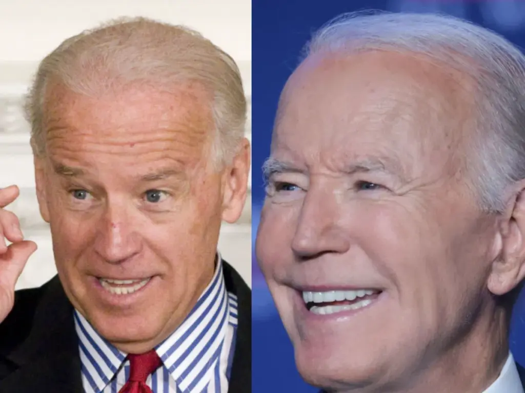 The Teeth of American Presidents: A Smile Makeover Race | LEMA