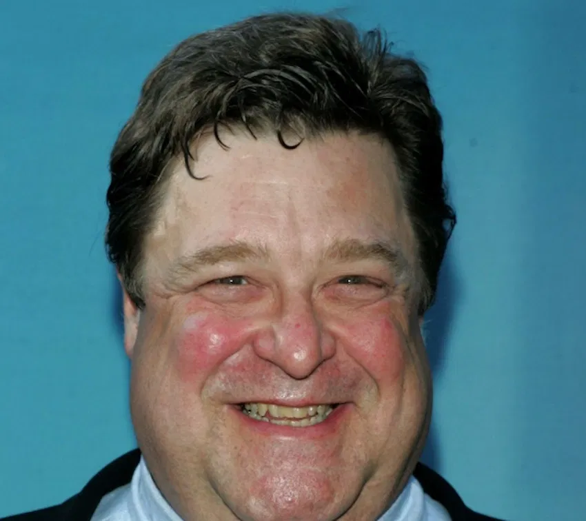 😁 John Goodman Dents (Anciennes/Nouvelles) : Avant et Après | Lema Dental Clinic