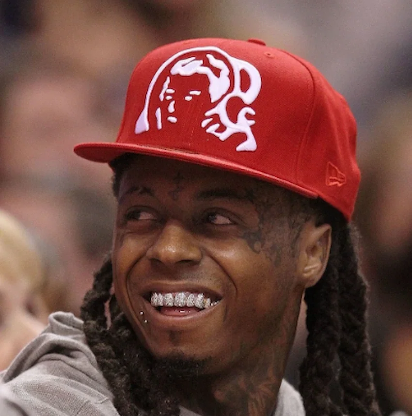 🧑‍🎤 Hollywood Smile: Lil Wayne's Shining Teeth | LEMA