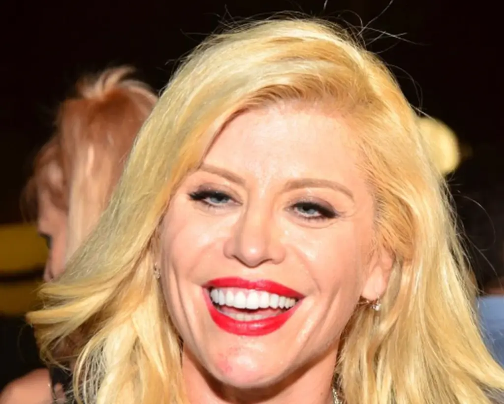 🎙️ Зубы Лореданы Грозы: до и после | LEMA