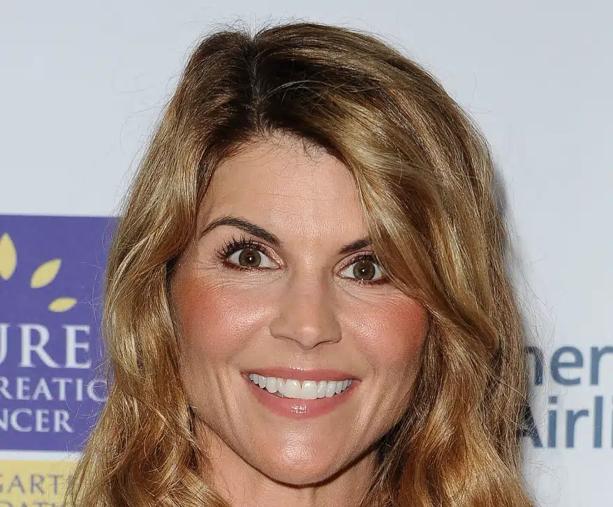 🤩 How Lori Loughlin Transformed Her Smile Over the Years | LEMA