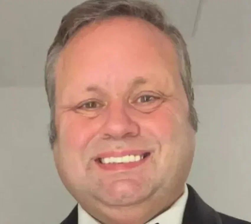 Paul Potts Dientes (Antiguos/Nuevos): Antes y Después | Lema Dental Clinic