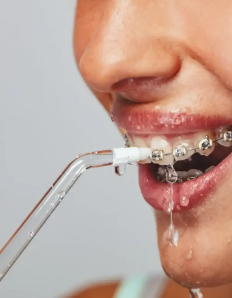 Does a Water Flosser Damage Teeth? | LEMA