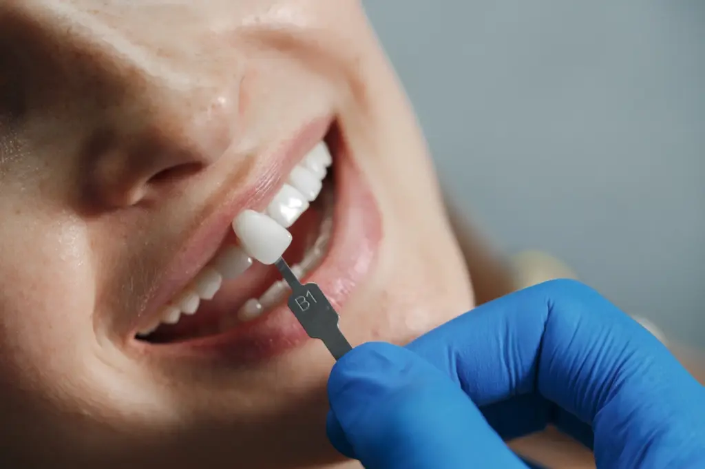 Shaved Teeth for Veneers: Risks, Benefits, and Procedure | LEMA