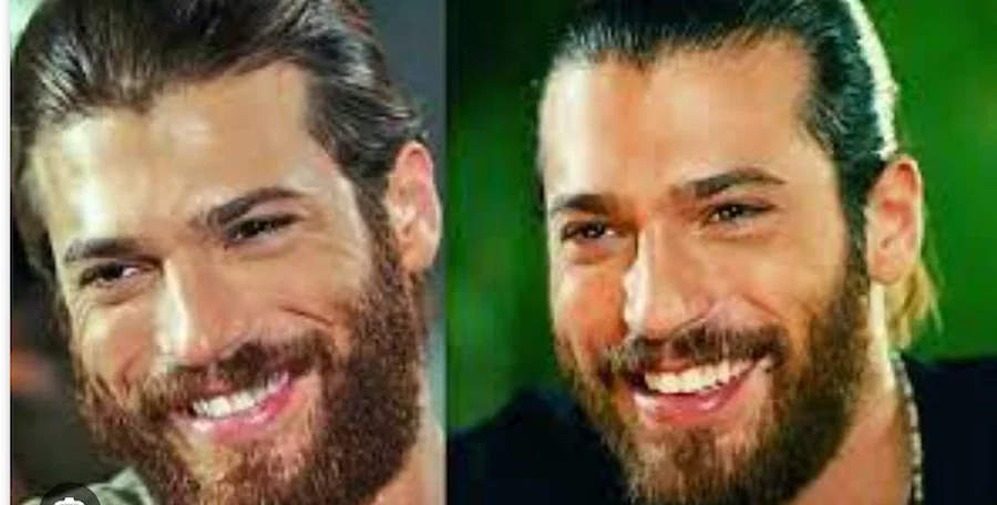 🧑 La evolución de la sonrisa de Can Yaman | Lema Dental Clinic