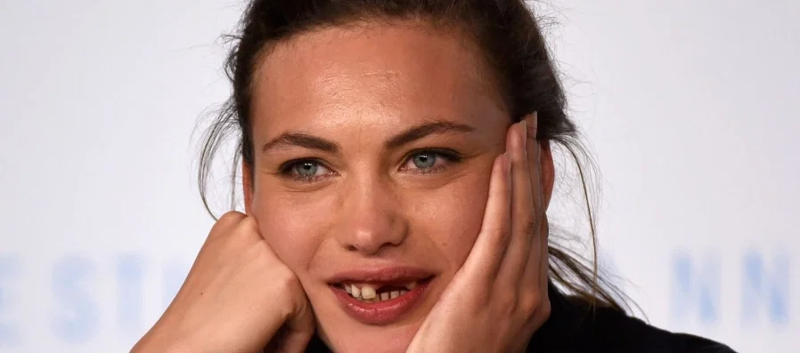 Est-ce qu'Aomi Muyock a fait réparer ses dents | Lema Dental Clinic