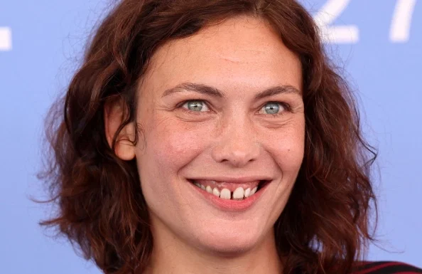 Est-ce qu'Aomi Muyock a fait réparer ses dents | Lema Dental Clinic