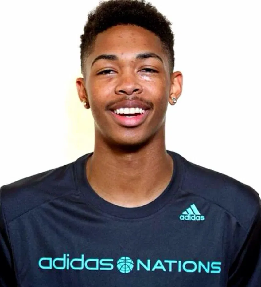 Brandon Ingram Antes ug After: Ang iyang Pagbag-o sa Ngipon