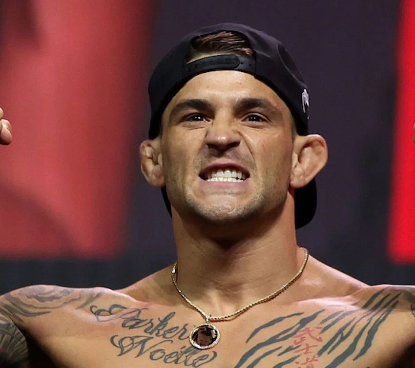 Los dientes de Dustin Poirier: Sonrisa perfecta en 2025