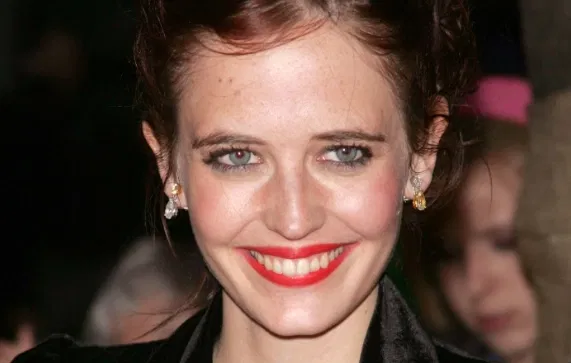 Eva Green’in Diş Dönüşümü: Öncesi ve Sonrası | Lema Dental Clinic