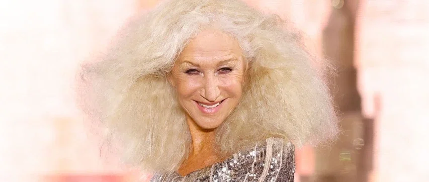Helen Mirren dantų transformacija: prieš ir po