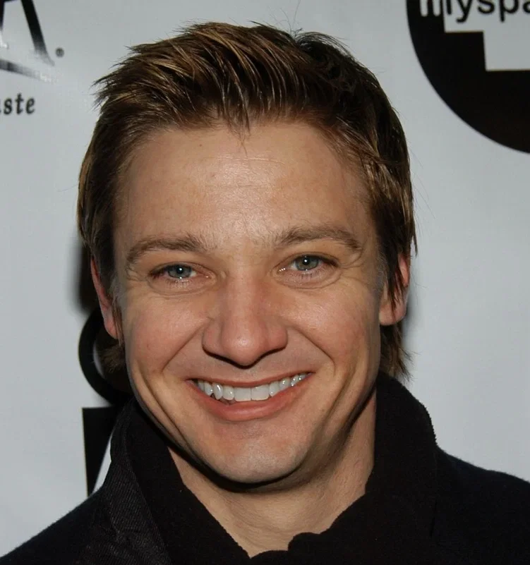Jeremy ‍ ‌‍ ‍‌ ‍ ‌‍ ‍‌ Renner’s Nieuwe Tanden Nu - Voor en Na