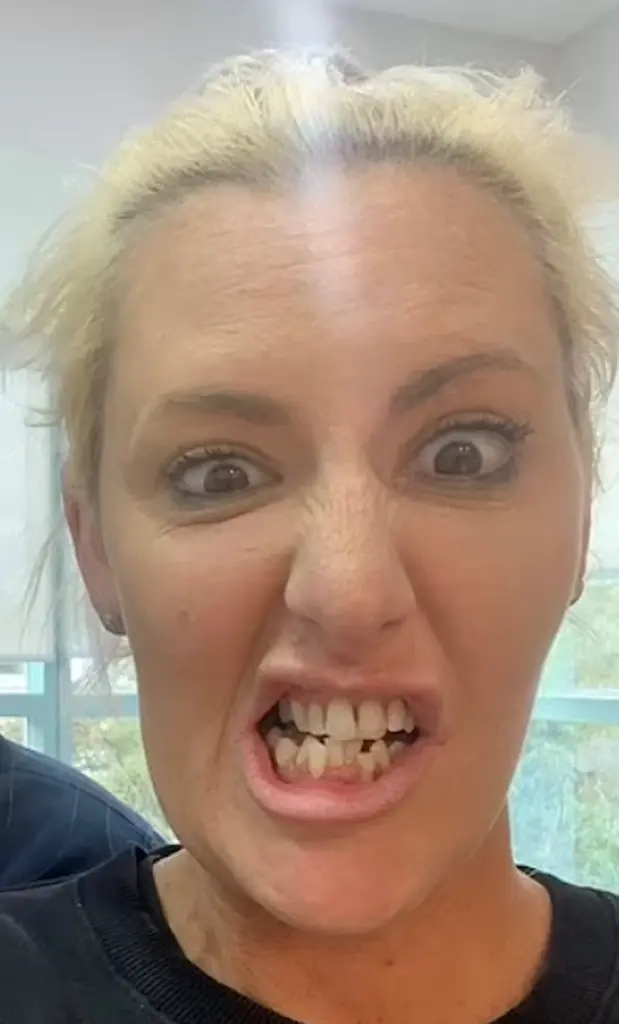 Jess Eva Teeth (Old/New): Before and Afters | LEMA