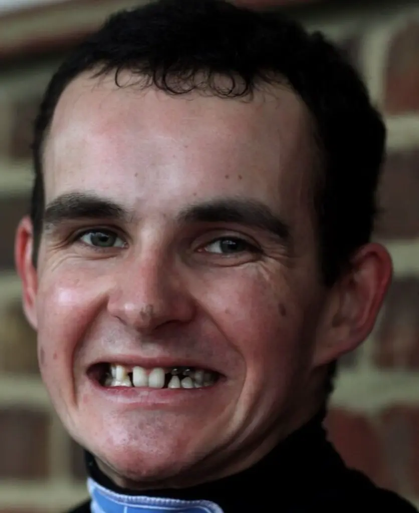 Liam Treadwell Teeth (Old/New): Before and Afters | LEMA