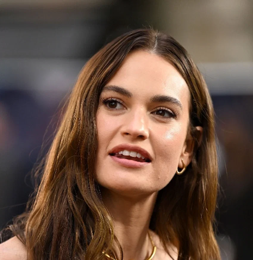 Lily James' Teeth (Old/New): Before and Afters | LEMA