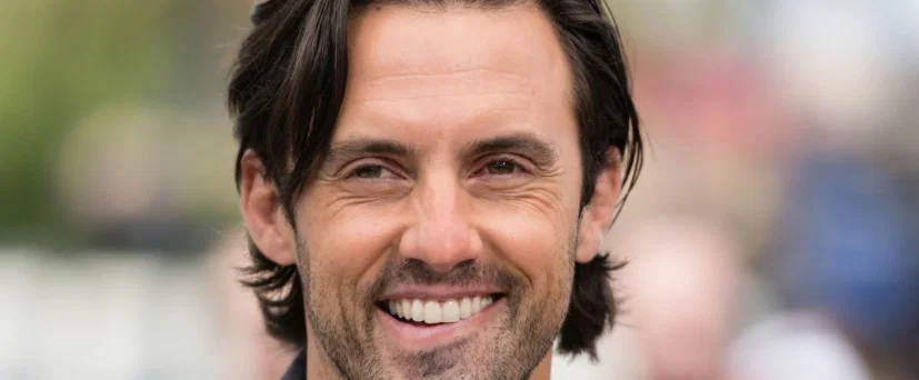 Milo Ventimiglia’s Iconic Smile: The Hollywood Teeth Secret | LEMA