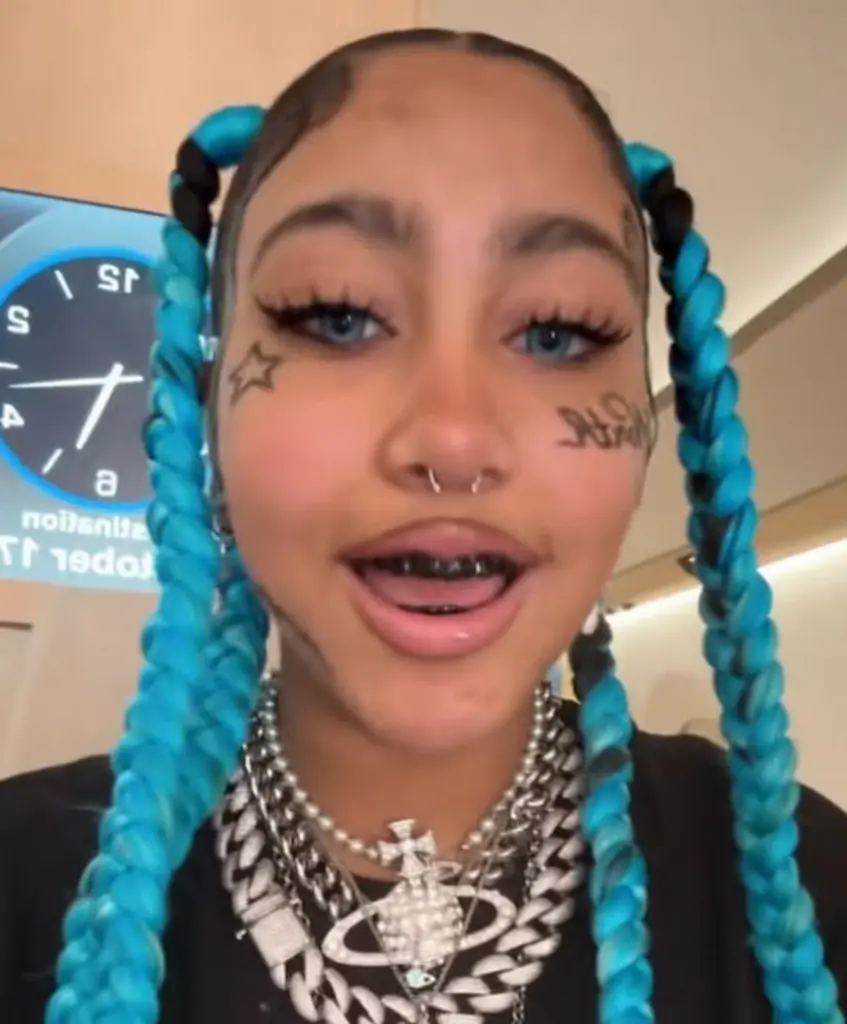 North West Teeth Journey: Braces, Diamonds, and Black Smile | LEMA