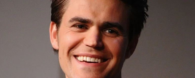 Paul Wesley's Teeth Transformation: Before and After | LEMA