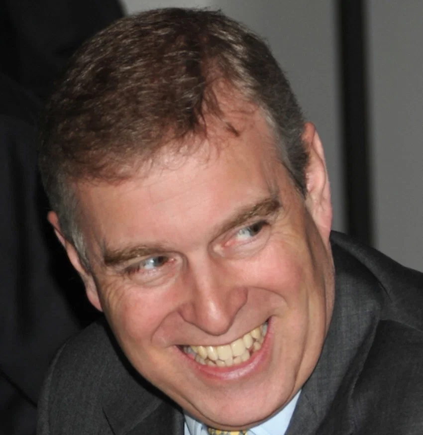 Prince Andrew Teeth (Old/New): Before and Afters | LEMA