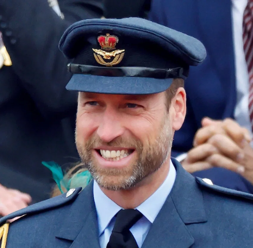 Prince William's Teeth (Old/New): Before and Afters | LEMA