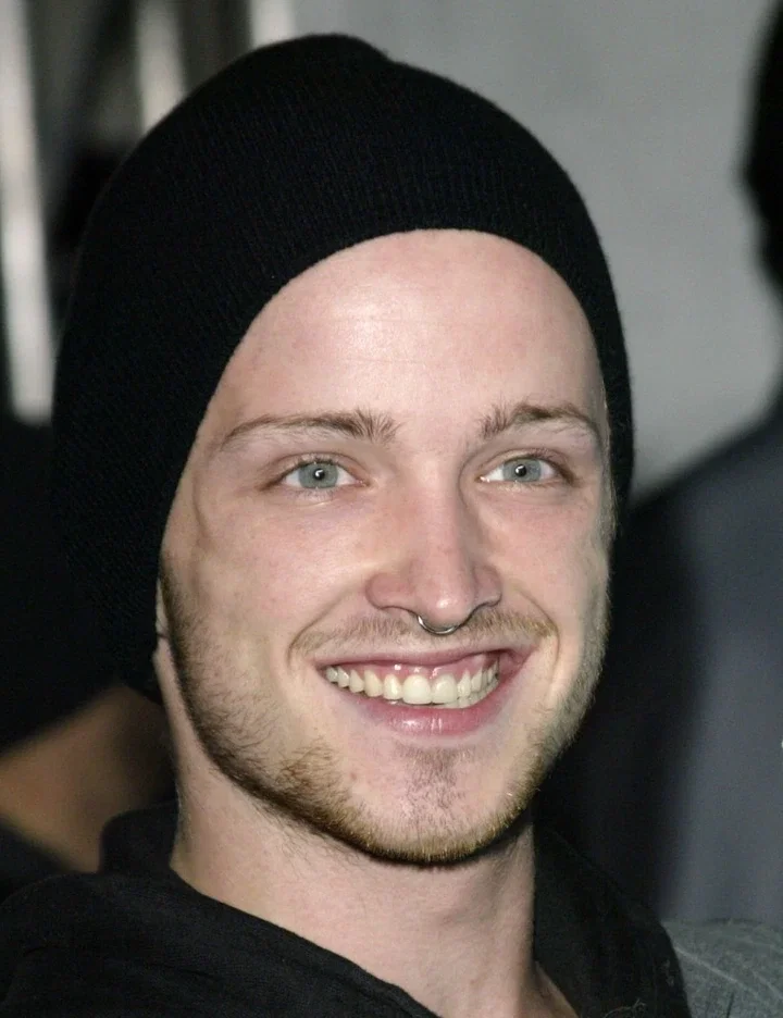 Aaron Paul's Teeth Transformation: Chemistry of a Perfect Smile | LEMA