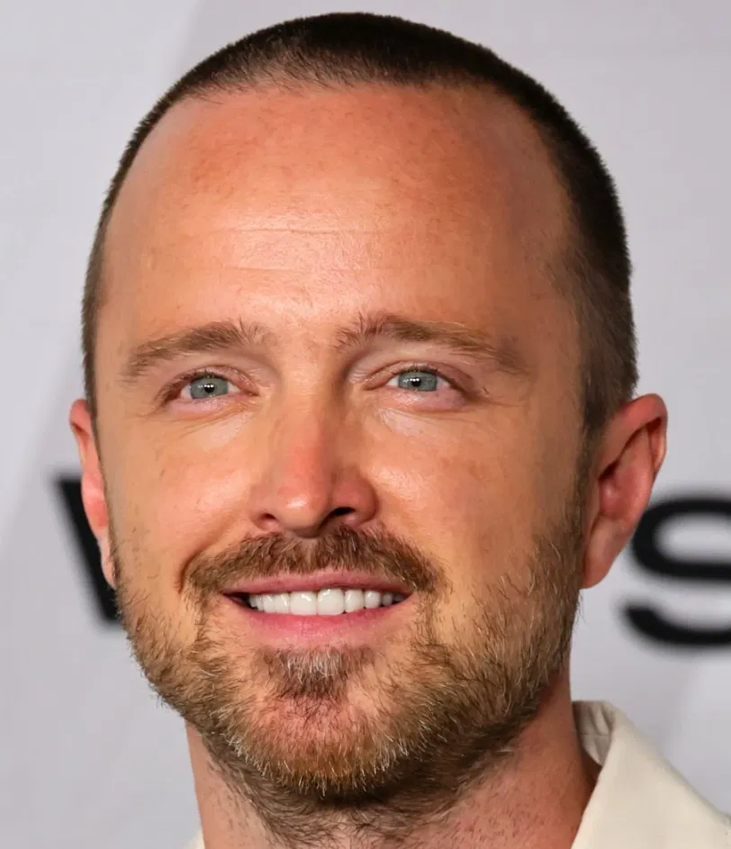 Aaron Paul's Teeth Transformation: Chemistry of a Perfect Smile | LEMA