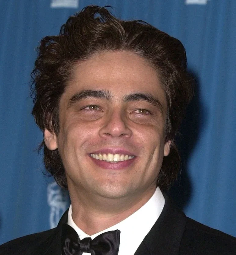 ¿Cómo han cambiado los dientes de Benicio del Toro? | Lema Dental Clinic