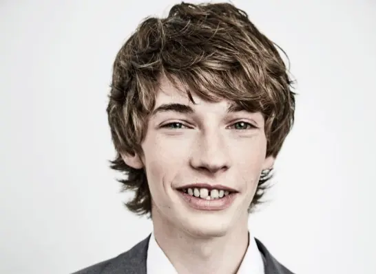 Did Jacob Lofland get his teeth fixed? | LEMA