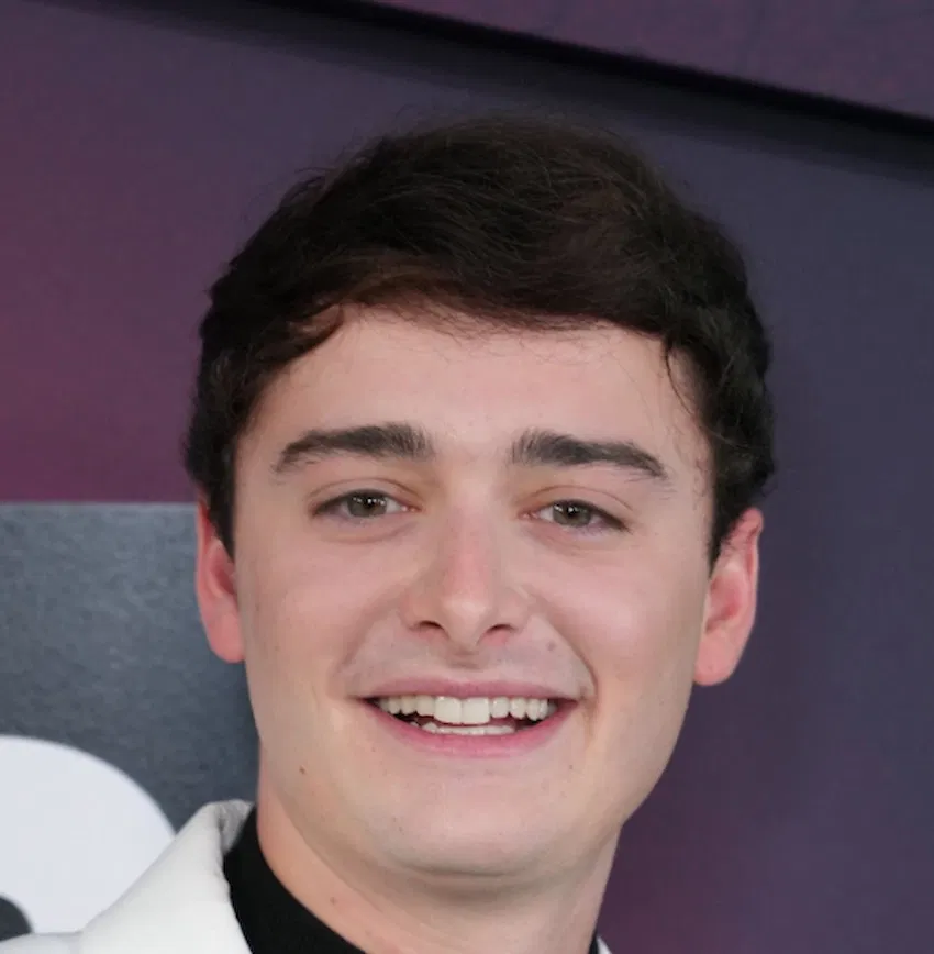 Noah Schnapp's Teeth: From Childhood to Hollywood Smile | LEMA