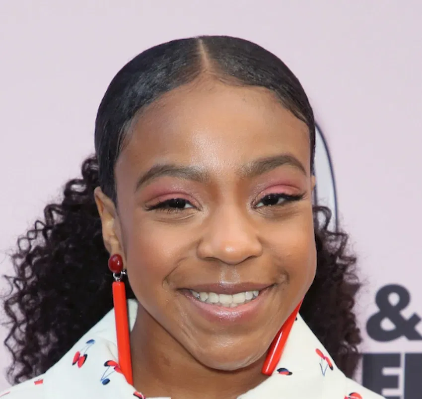 Come è cambiato il sorriso di Priah Ferguson