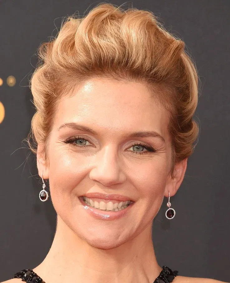 Rhea Seehorns Zähne 'Pluribus' Update - Perfektes Weiß | Lema Dental Clinic