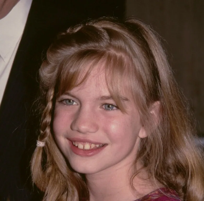 Anna Chlumsky Teeth (Old/New): Before and Afters | LEMA