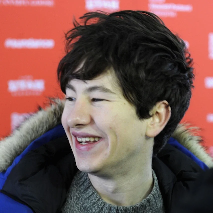 Barry Keoghan’s Stunning Smile Transformation: Before and After | LEMA