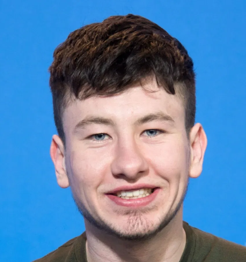 Barry Keoghan’s Stunning Smile Transformation: Before and After | LEMA