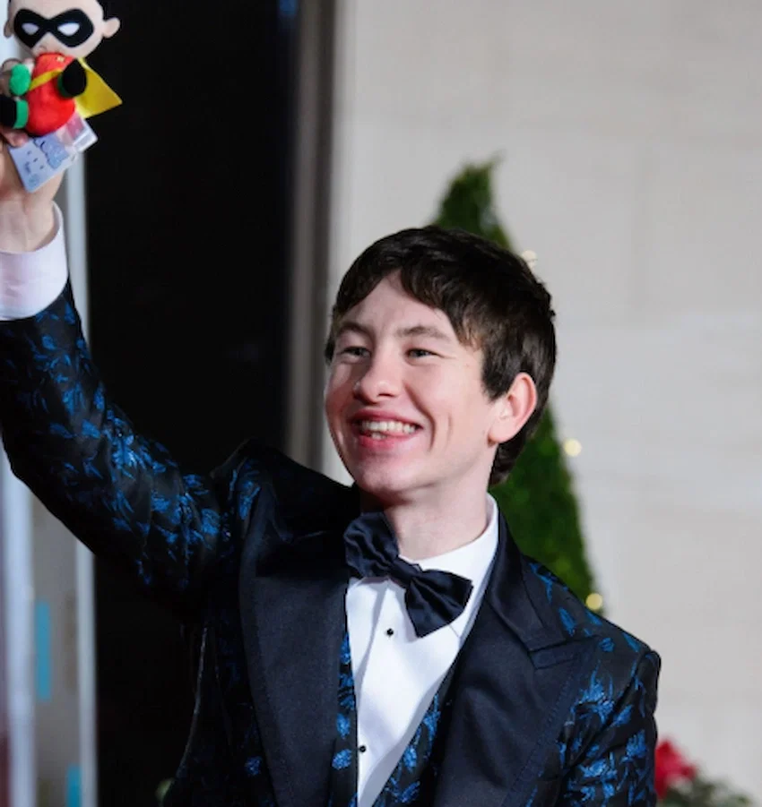 Barry Keoghan’s Stunning Smile Transformation: Before and After | LEMA