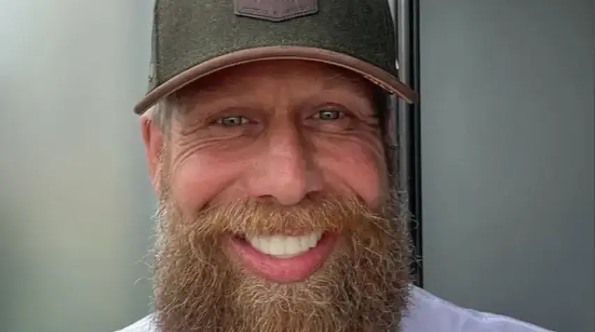 Buzz Gold Rush Teeth: How Buzz Legault Transformed His Smile | LEMA