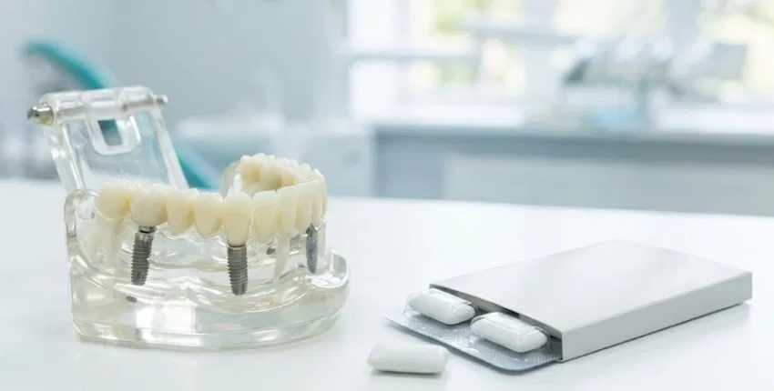 Poți mesteca gumă cu implanturi dentare All-on-4 | Lema Dental Clinic