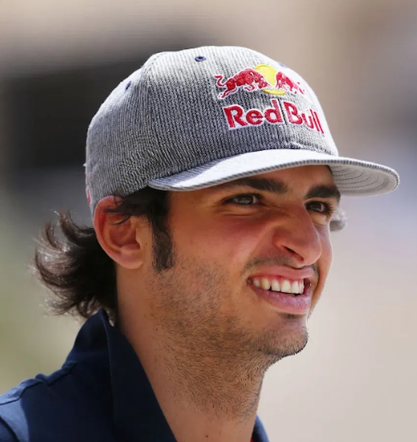 Carlos Sainz's Teeth: Are Carlos Sainz's Teeth Real? | LEMA