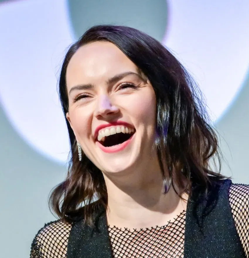 ¿Cómo logró Daisy Ridley la sonrisa perfecta | Lema Dental Clinic