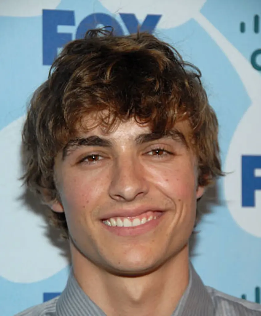 Dave Franco Dantys Anksčiau ir Po: Šiuolaikiniai šypsenos