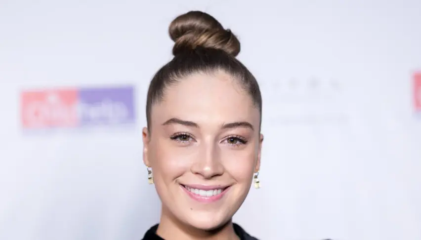 Elsie Hewitt Tanden: Heeft ze een Hollywood Smile gekregen?